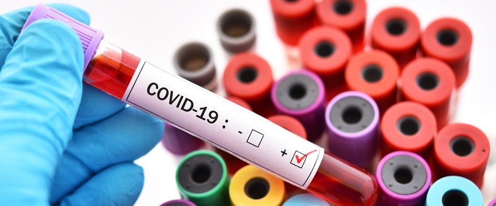 COVID Q&A with Dr. Elizabeth Godbey on blood supply - Department of ...